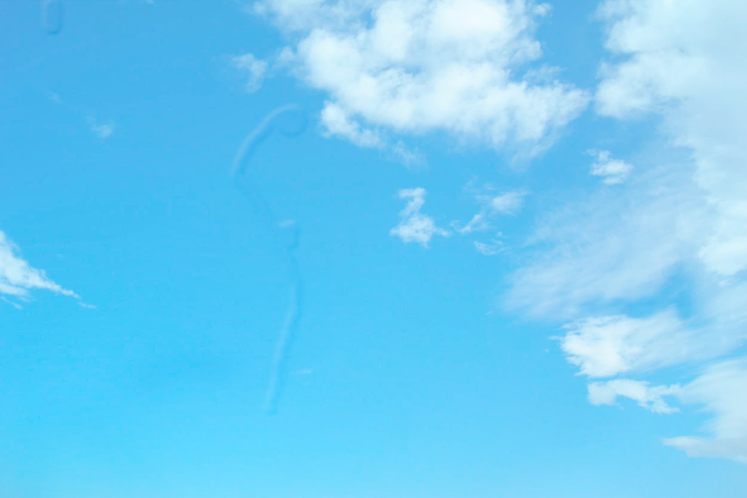 ¿Qué son las moscas flotantes? Causas, síntomas y tratamientos